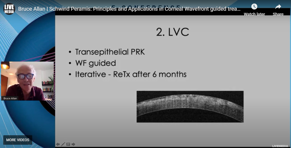 Bruce Allan MD, FRCS – Schwind Peramis: Principles and Applications in ...