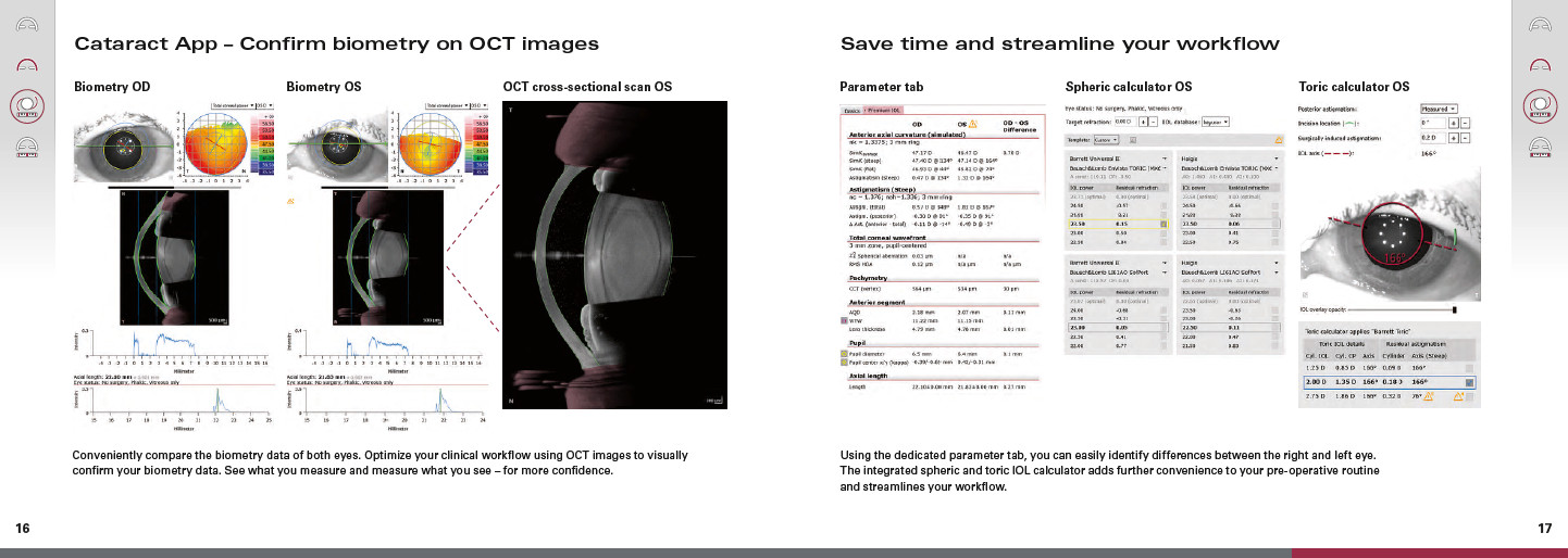Το 1ο διαγνωστικό σύστημα Heidelberg Anterion στην Ελλάδα στο ...