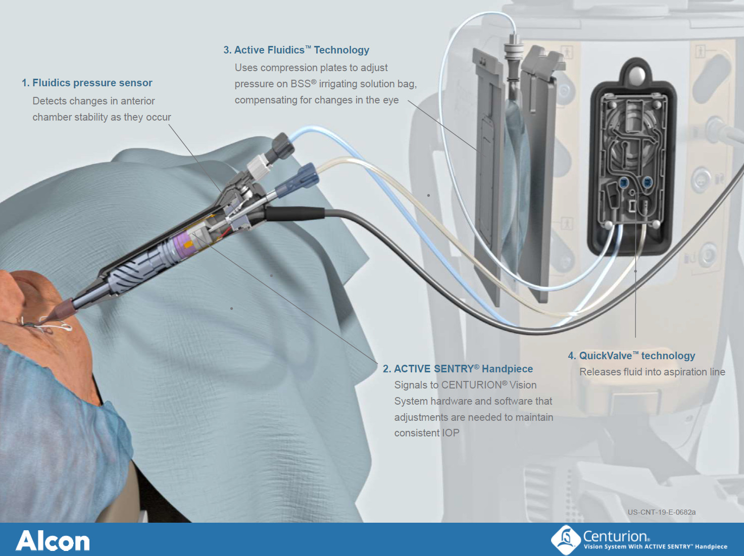 Το νέο, επεμβατικό σύστημα φακοθρυψίας Alcon Centurion με τεχνολογία ...