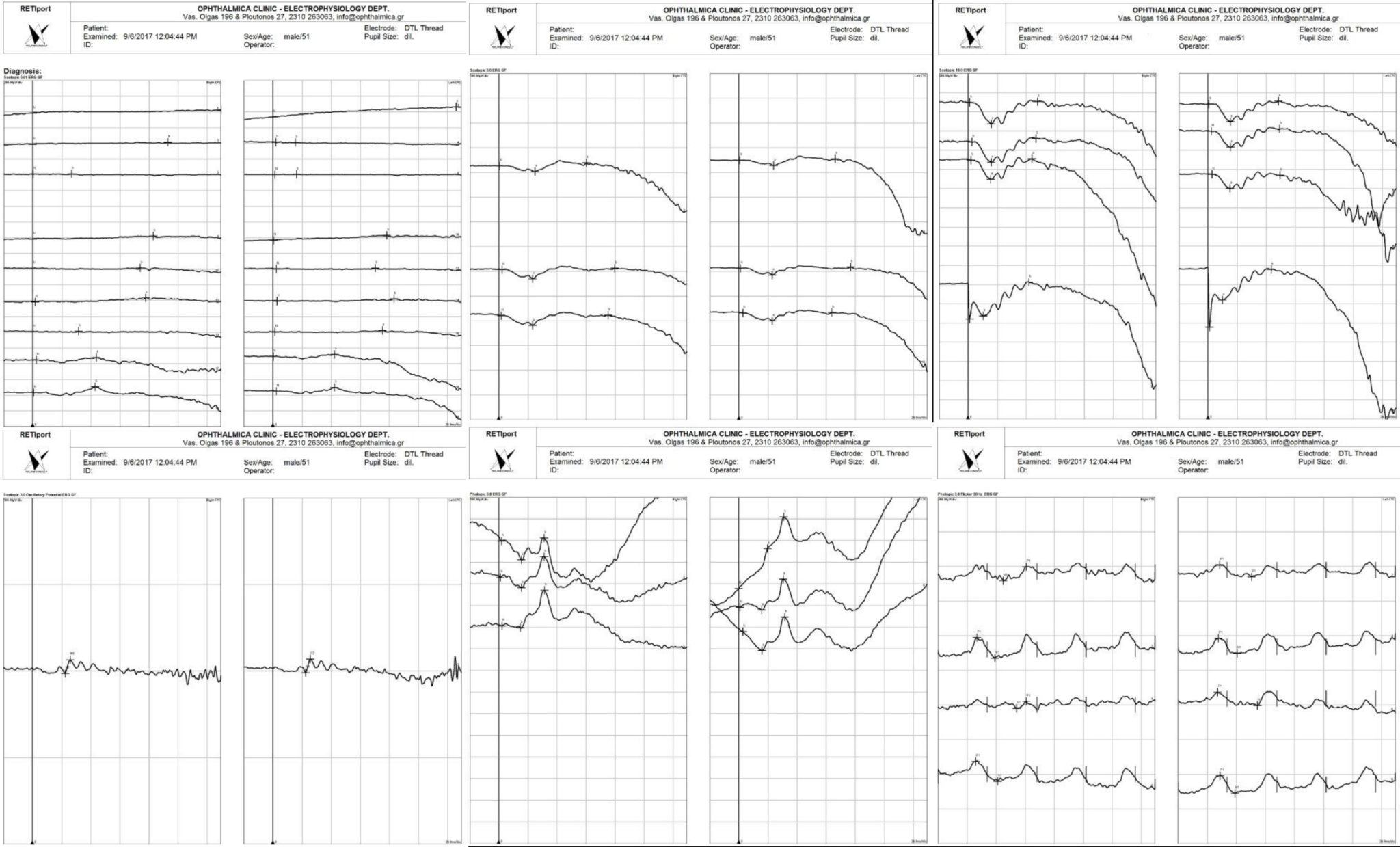 Case of the month (Sep 2021) - Οφθαλμολογικό Κέντρο Ophthalmica