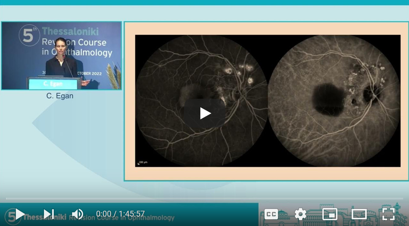 Day 2 – Advanced Medical Retina & Uveitis | 5th Thessaloniki Revision ...