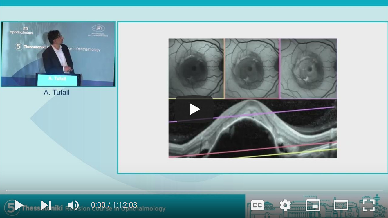 Day 2 – Medical Retina (Intermediate) 1 | 5th Thessaloniki Revision ...